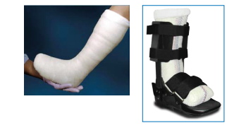 Diabetic Charcot Foot - University Hospitals Sussex NHS Foundation Trust