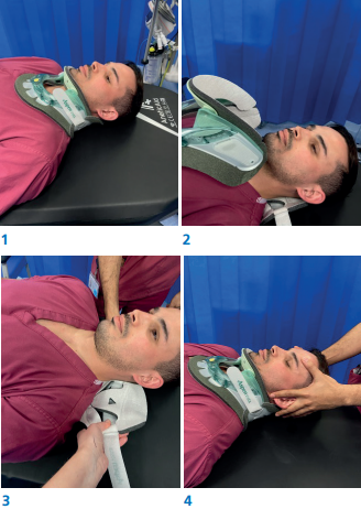 Spinal Collar Guidance - University Hospitals Sussex NHS Foundation Trust