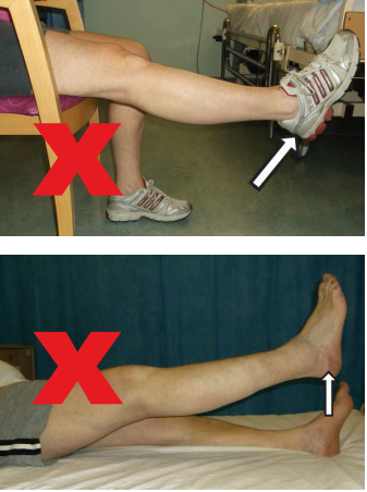 Advice following anterior cruciate ligament (ACL) reconstruction ...