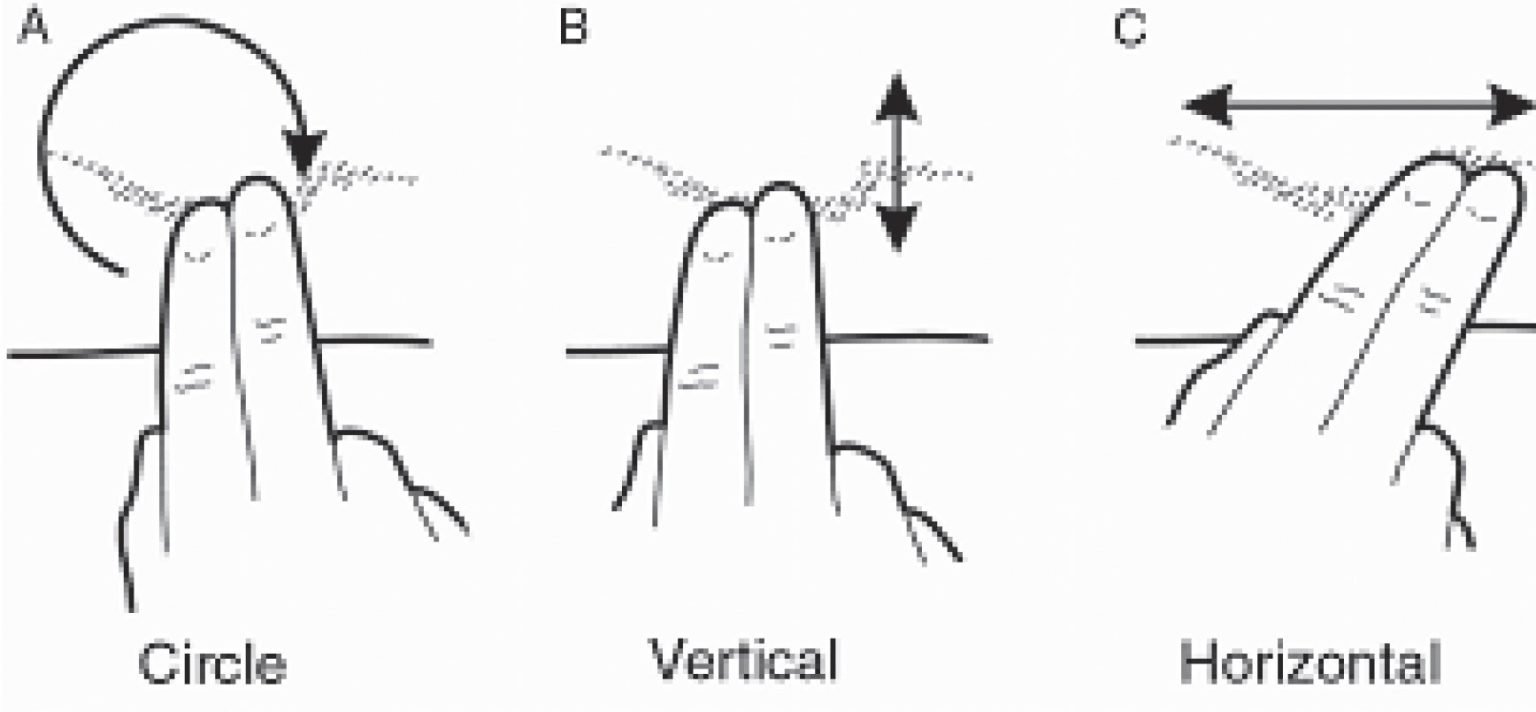 Managing your scar - University Hospitals Sussex NHS Foundation Trust