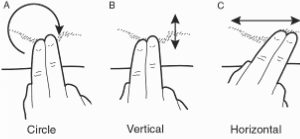 Managing your scar - University Hospitals Sussex NHS Foundation Trust
