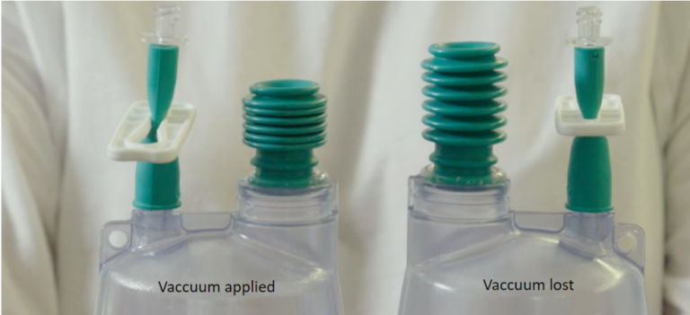 Going home with a wound drain - University Hospitals Sussex NHS ...