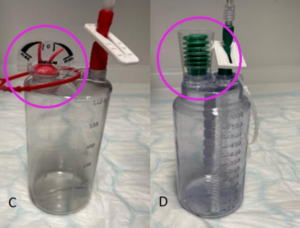 Your abdominal drain passport - University Hospitals Sussex NHS ...