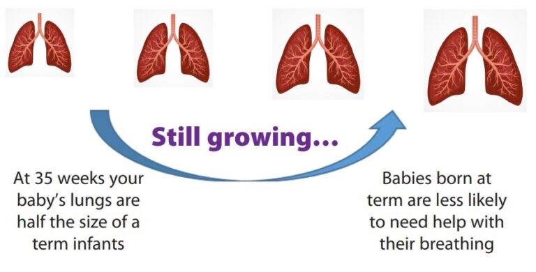 Early Term birth. ‘Every week counts’. - University Hospitals Sussex ...