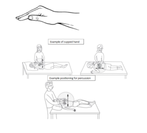 Information on Percussion Techniques - University Hospitals Sussex NHS ...