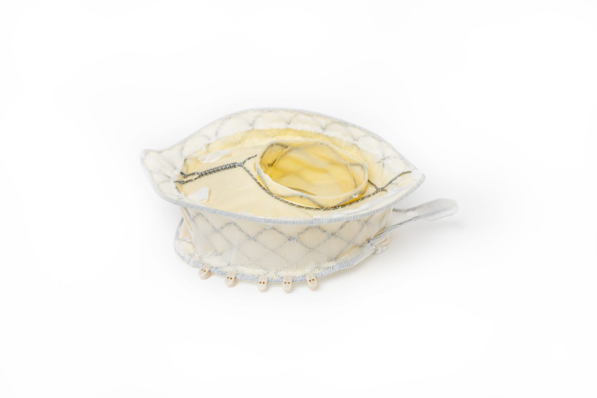 Cardiac team triumphs with ‘breakthrough’ heart valve replacement ...